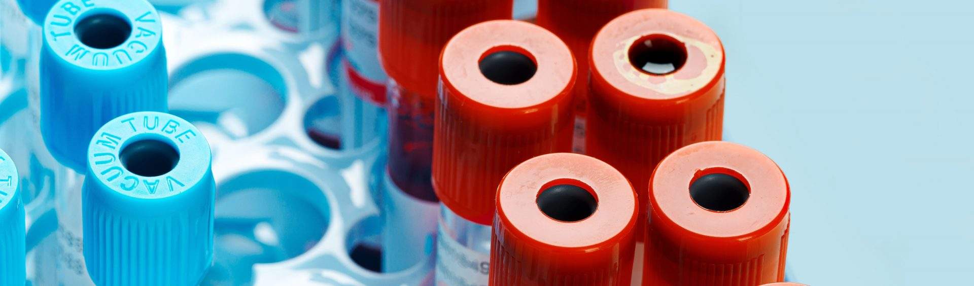 Lactato: entenda o que é e porque pode estar alto - Vitat