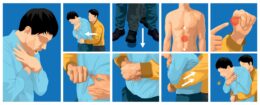 'Desengasgador' funciona? Manobra de Heimlich ainda é a melhor opção